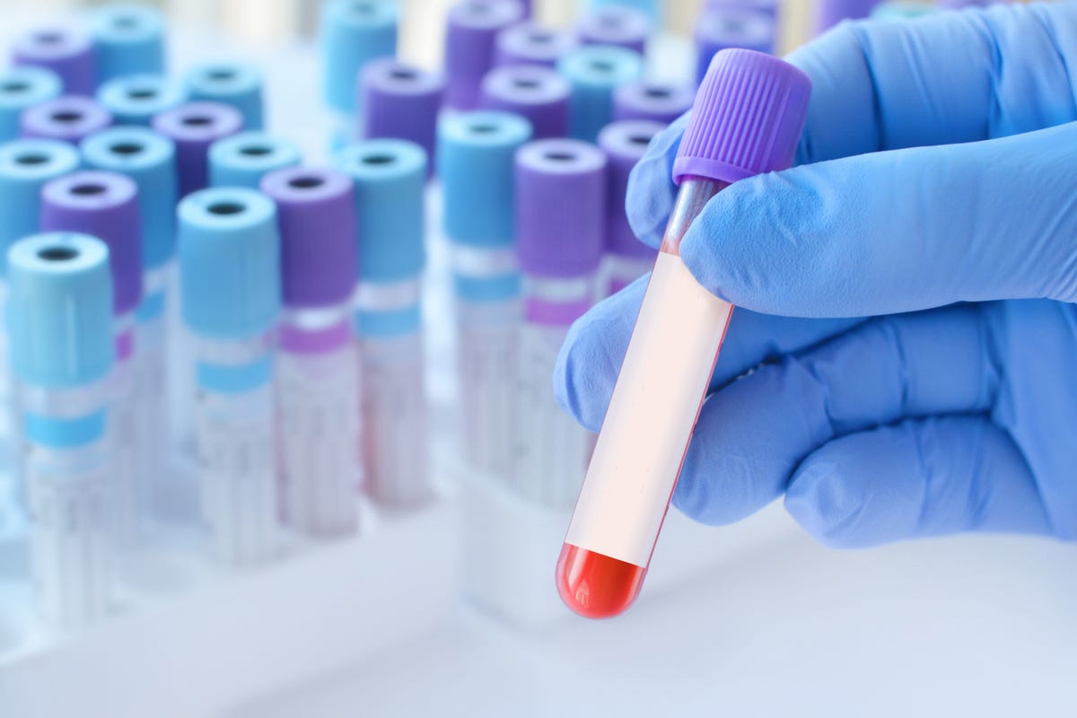 Blood Tests That Can Detect Cancer