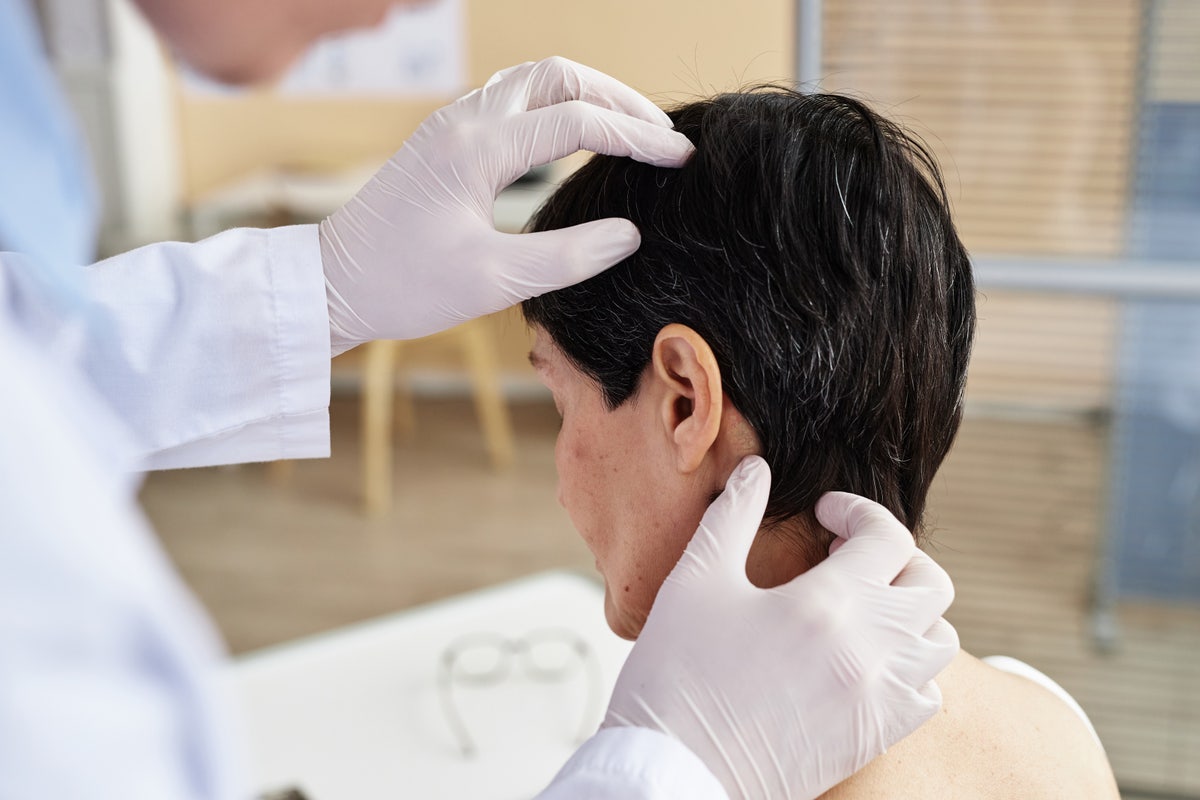 Treatment Options for Scalp Cancer