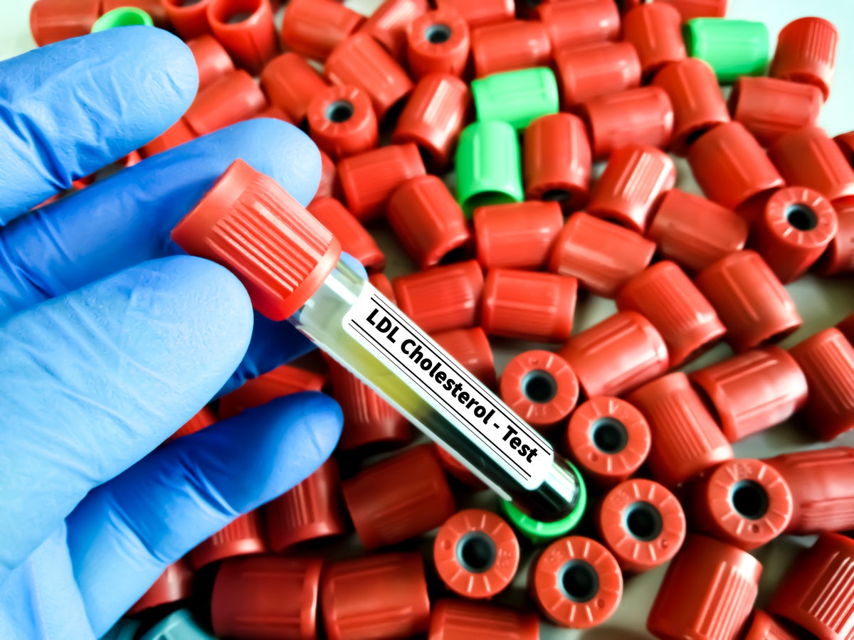 Diagnosing High Cholesterol