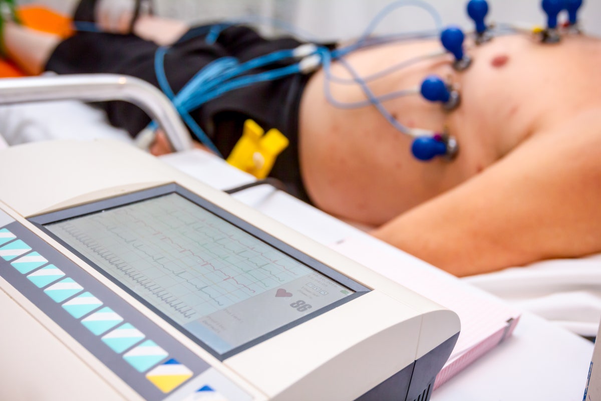 Diagnosing Postural Orthostatic Tachycardia Syndrome (POTS)