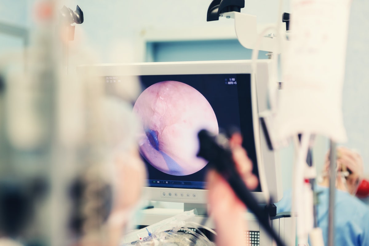 Diagnosing Achalasia (Cardiospasm)