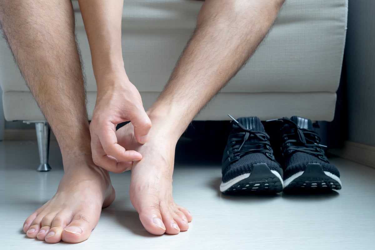 Itchy Skin as a Symptom of Graves’ Disease