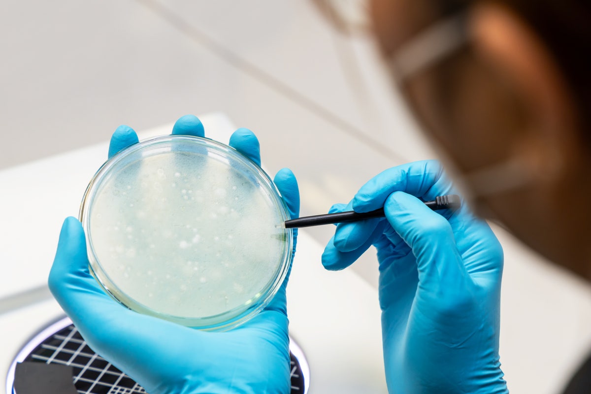 Chlamydia and Infertility in Females